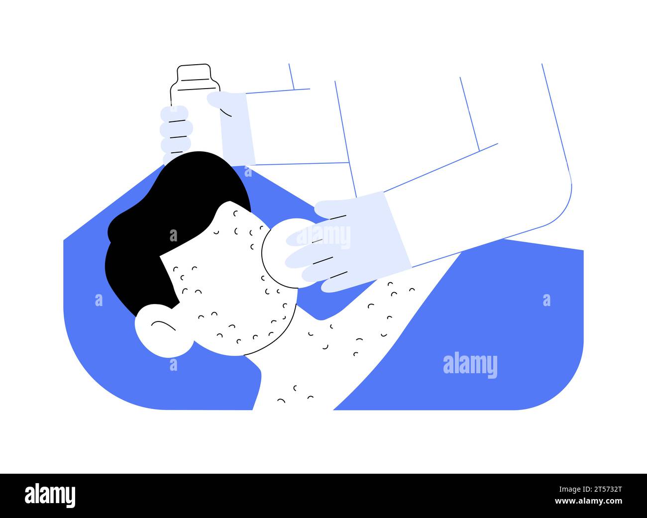 Acne treatment abstract concept vector illustration Stock Vector Image ...