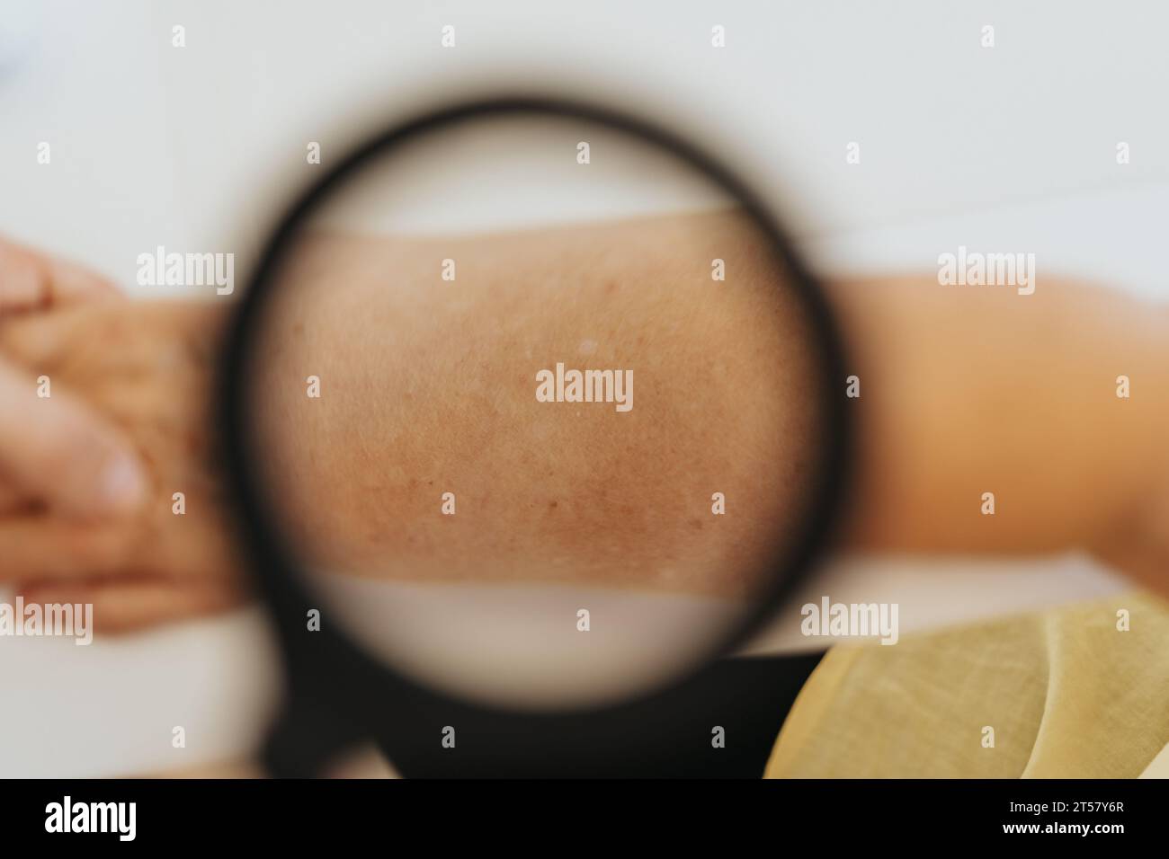 Doctor checking patient skin using magnifying glass. Close up photo ...