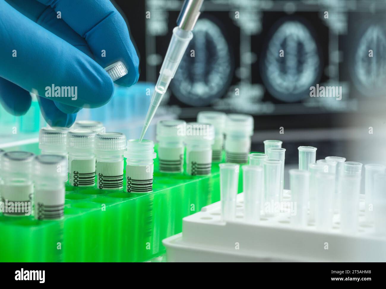 Memory disorder research hi-res stock photography and images - Alamy