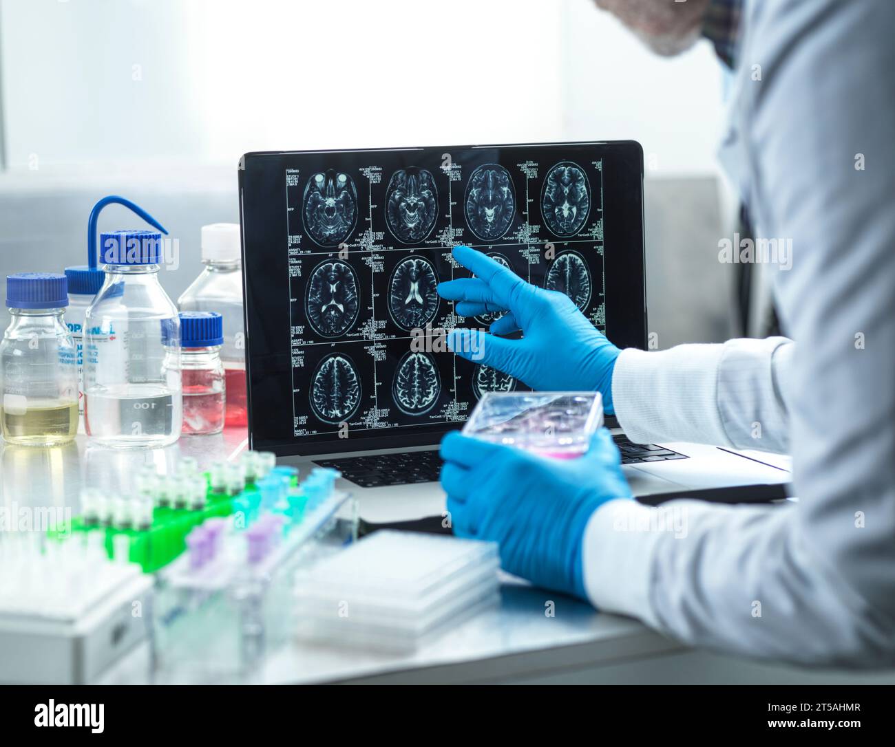 Memory disorder research hi-res stock photography and images - Alamy