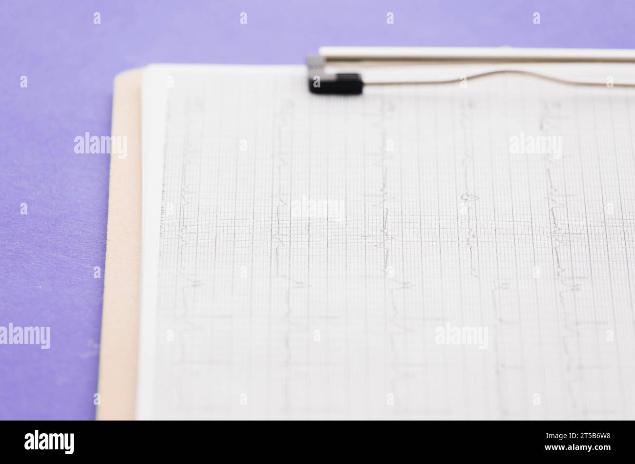 Cardiogram ecg graph clipboard purple background Stock Photo - Alamy