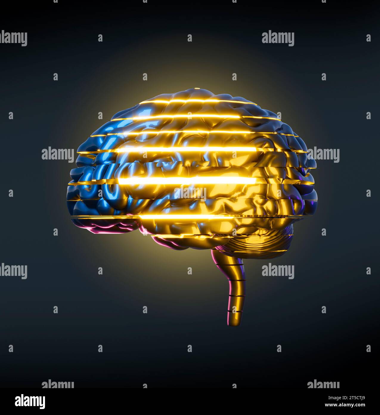 Memory lapses, forgetting things, degenerative disease. Brain problems ...