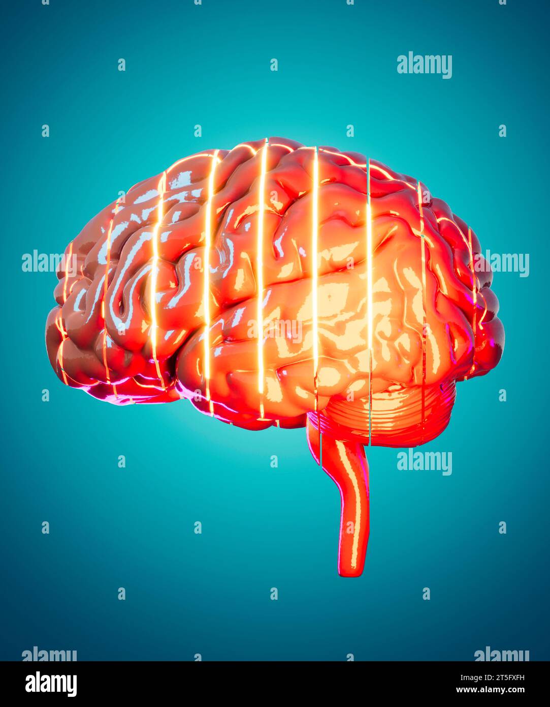 Memory lapses, forgetting things, degenerative disease. Brain problems ...