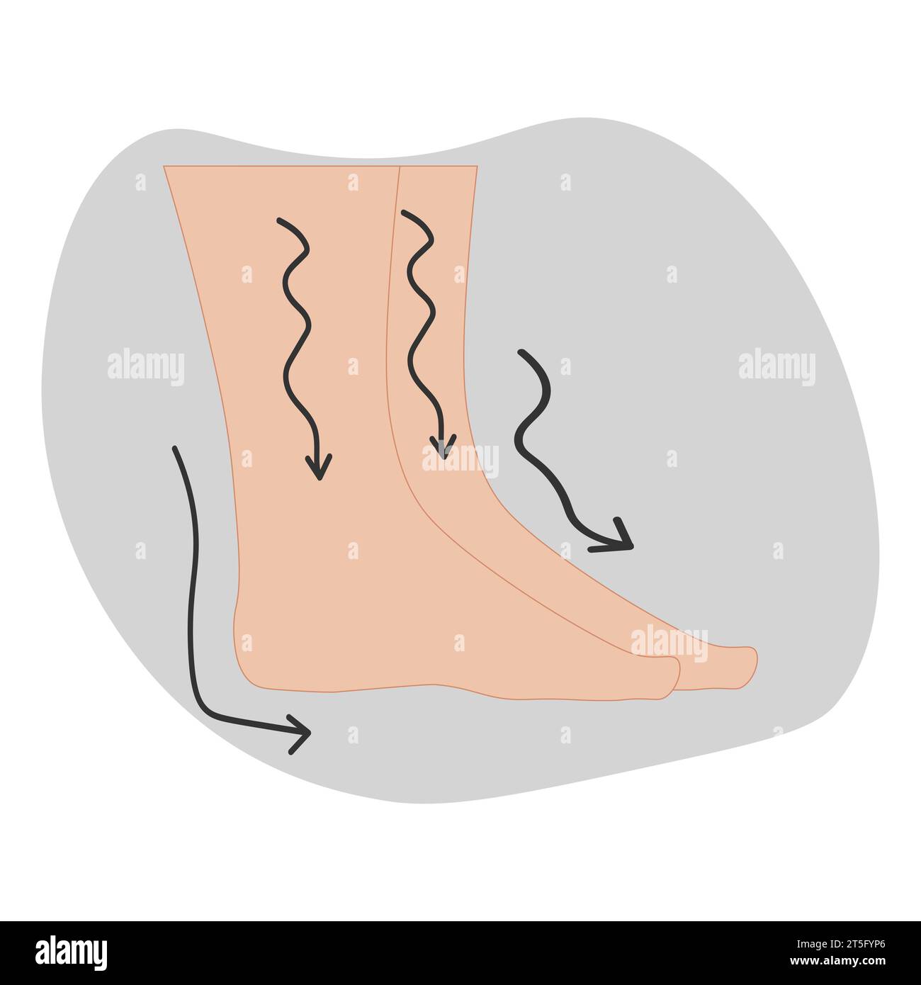 Swelling leg Cut Out Stock Images & Pictures - Alamy