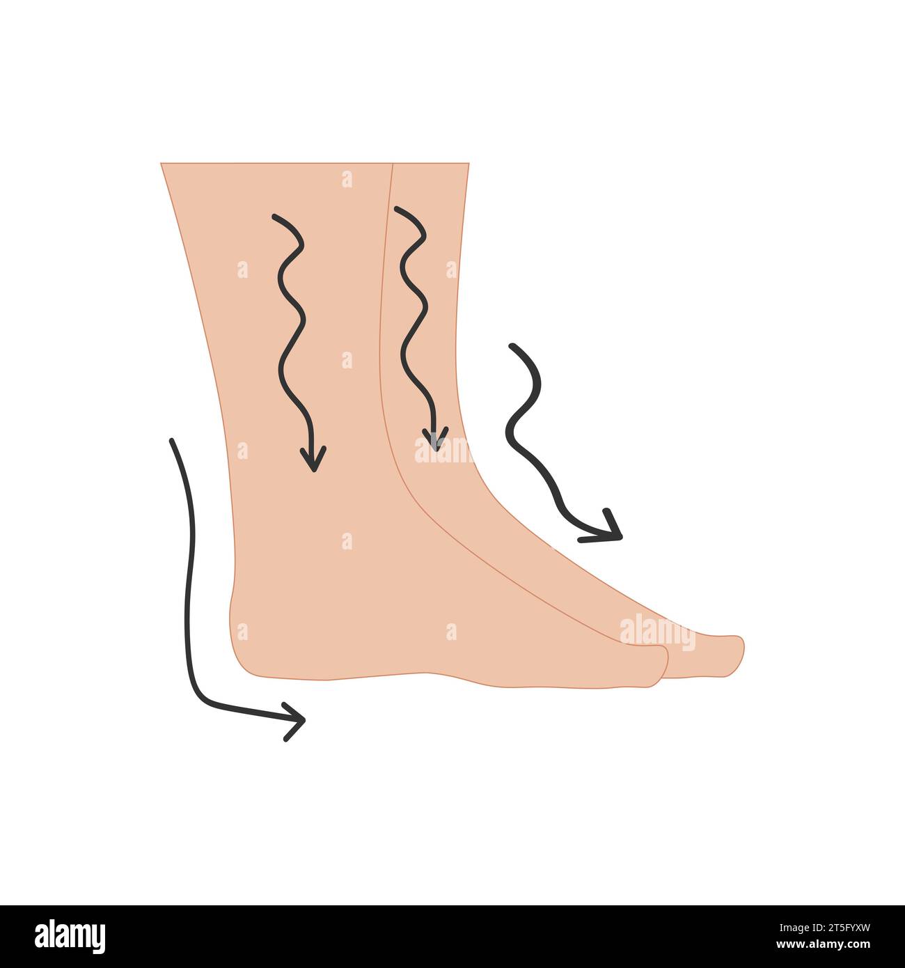Swelling leg Cut Out Stock Images & Pictures - Alamy
