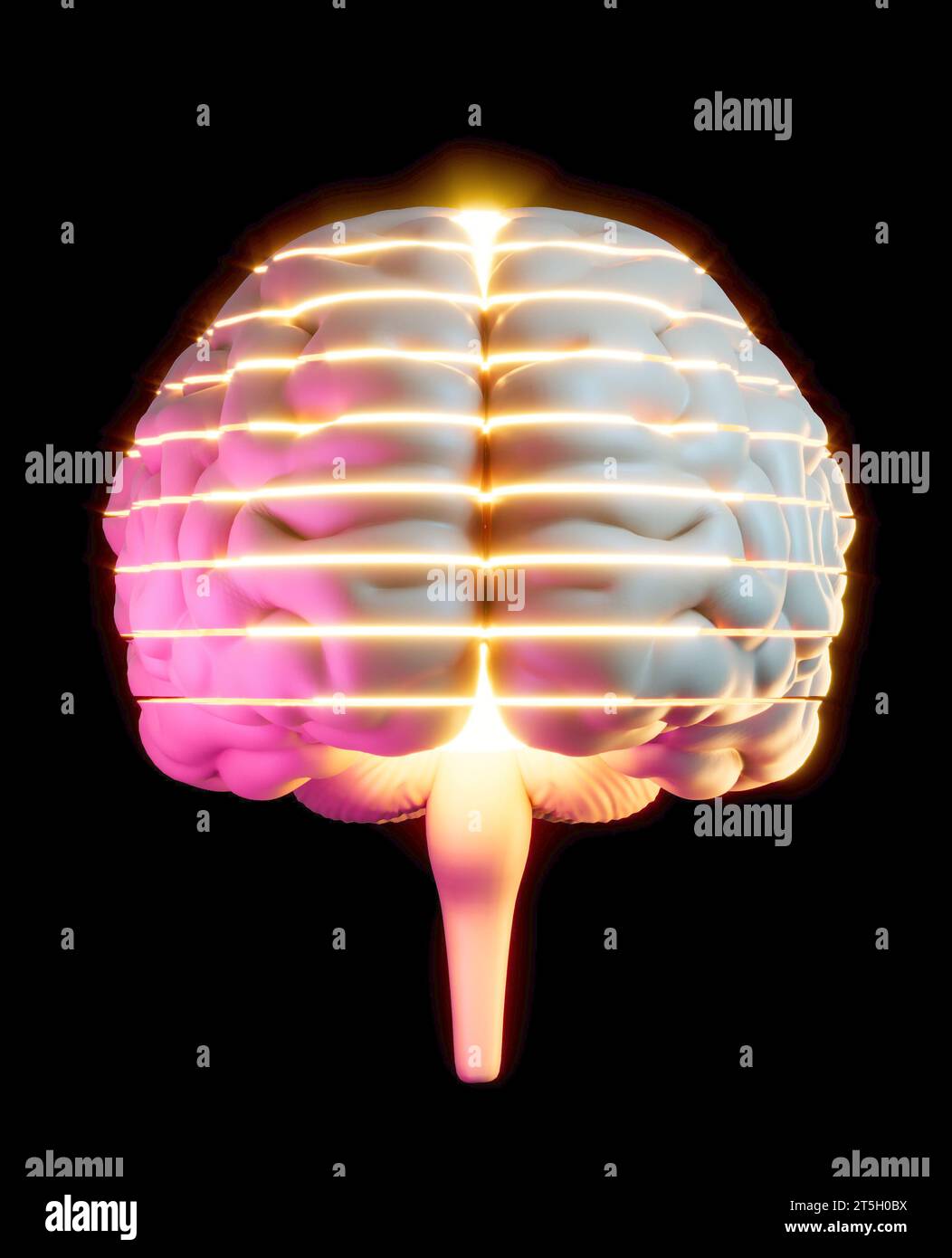 Memory lapses, forgetting things, degenerative disease. Brain problems ...