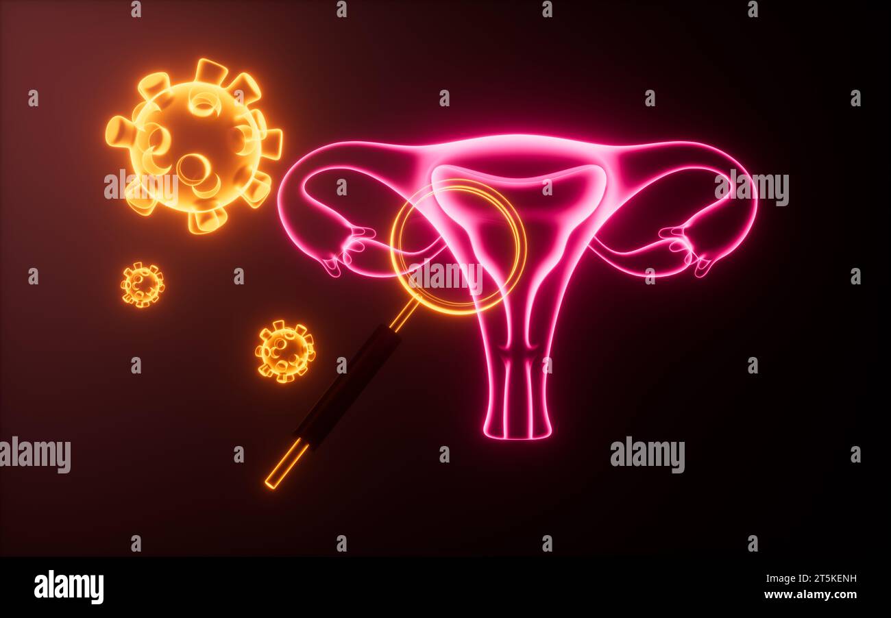 Virus attack uterus, hpv infection, female reproductive system, 3d ...