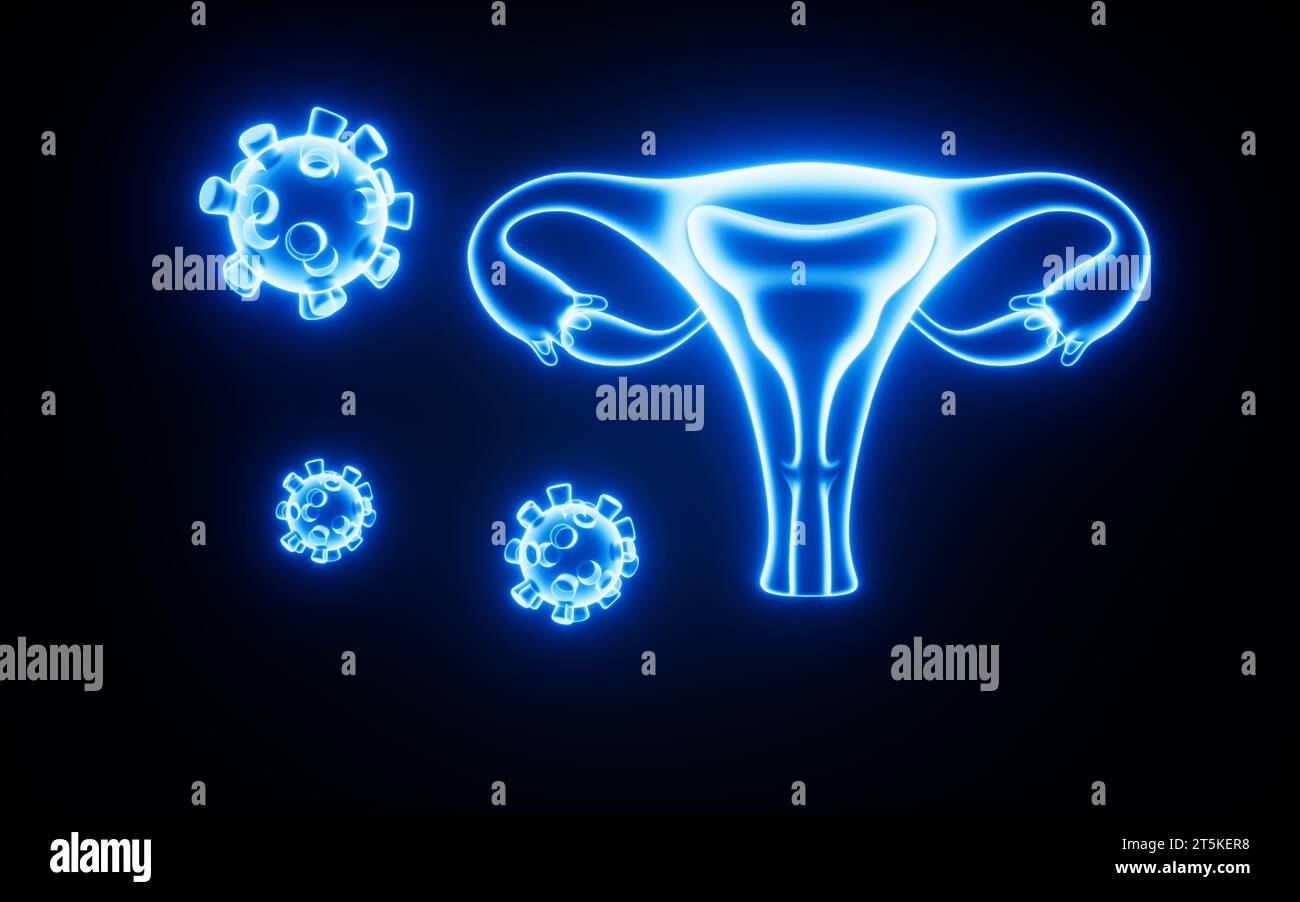 Virus attack uterus, hpv infection, female reproductive system, 3d ...