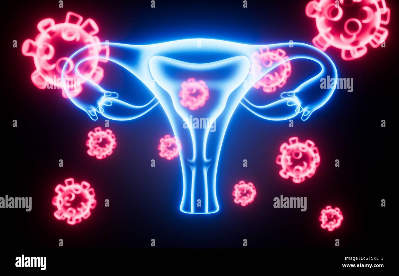 Virus attack uterus, hpv infection, female reproductive system, 3d ...
