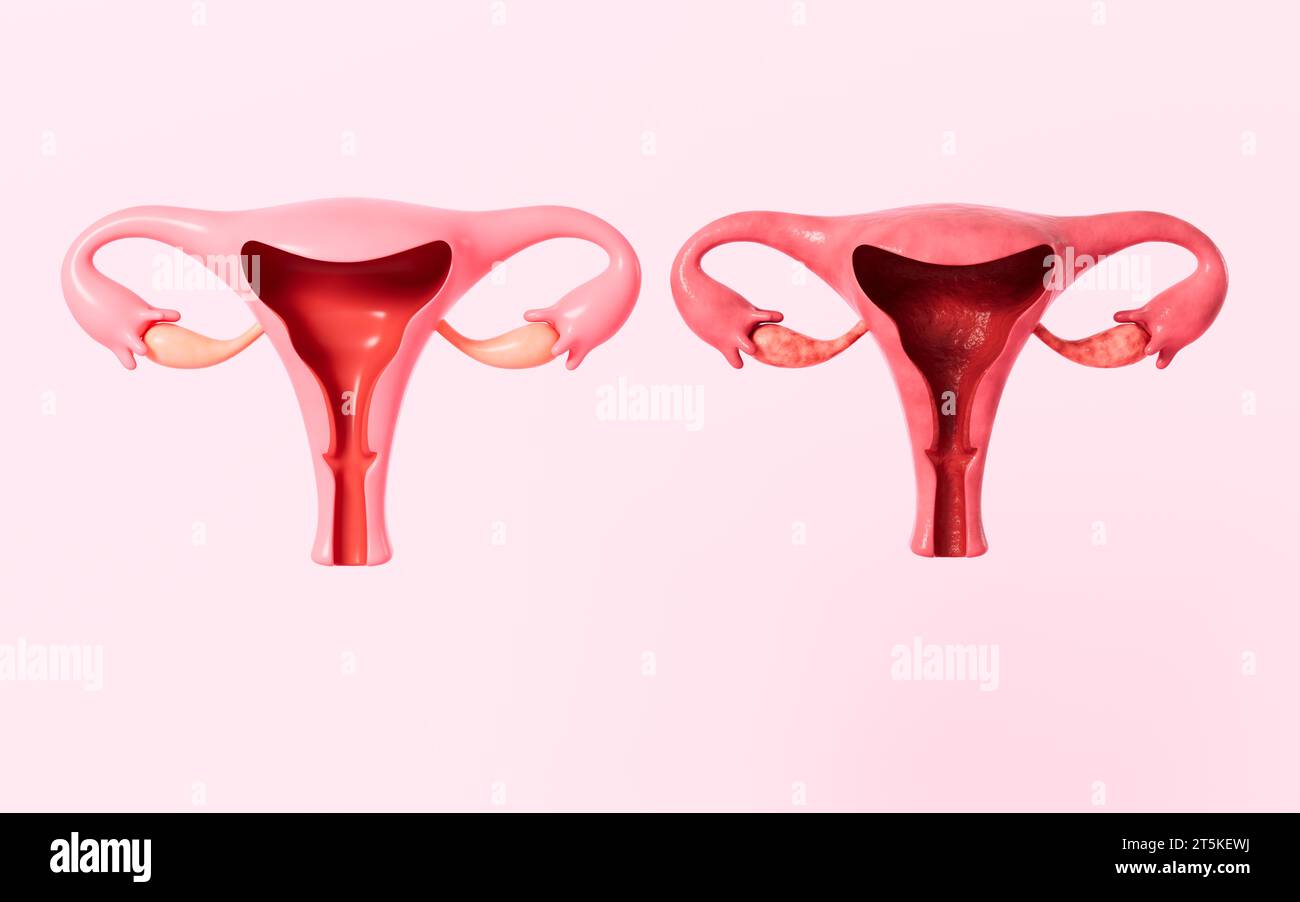 Female reproductive system model hi-res stock photography and images ...