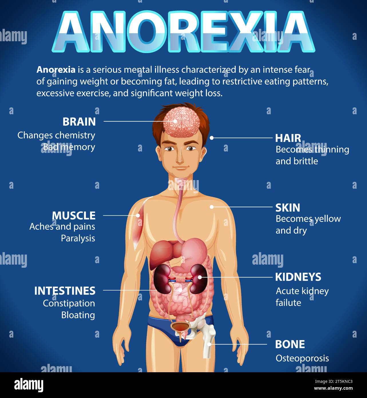 Illustration depicting the impact of Anorexia on various body functions ...