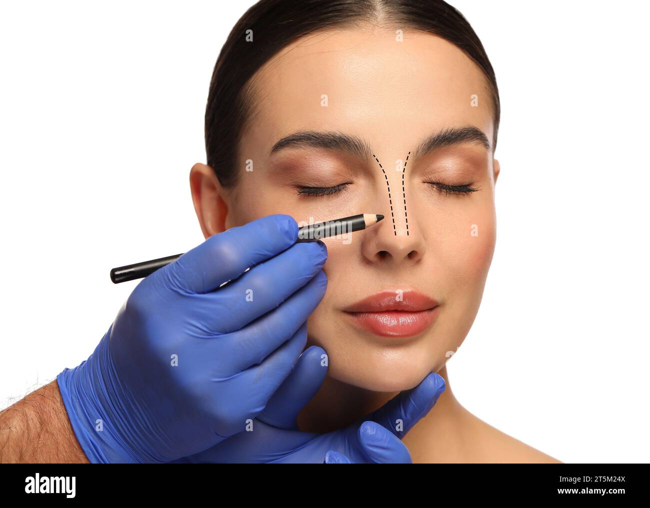 Woman preparing for cosmetic surgery, white background. Doctor drawing ...
