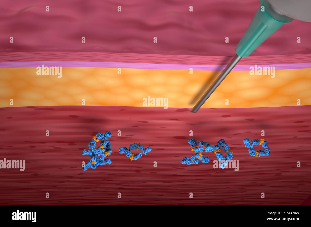 Monoclonal antibody treatment (Adalimumab) - top view 3d illustration ...