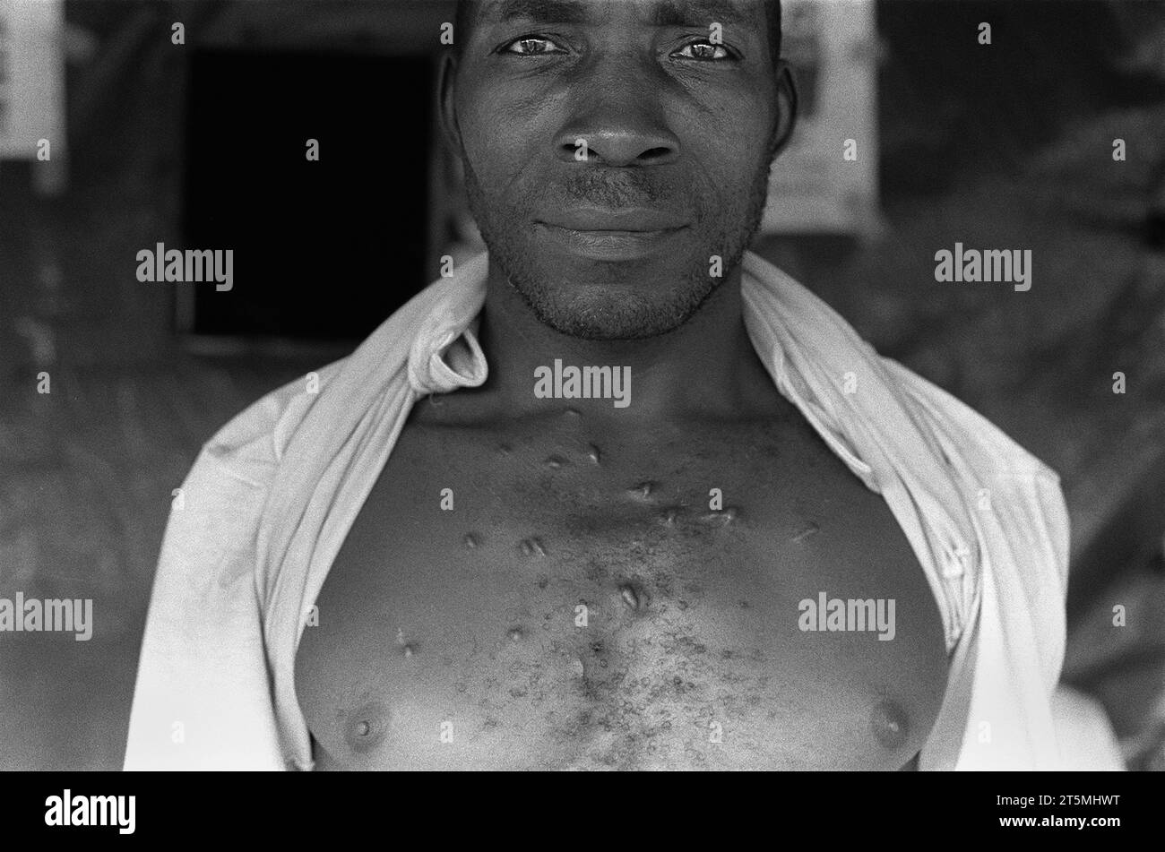 Bala Koroma was shot in the chest by a shotgun when the rebels took his ...