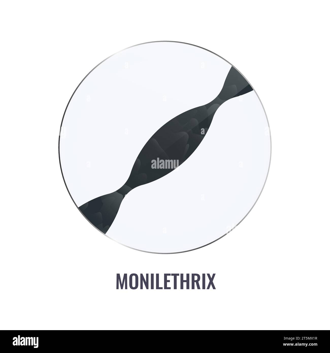 Monilethrix hi-res stock photography and images - Alamy