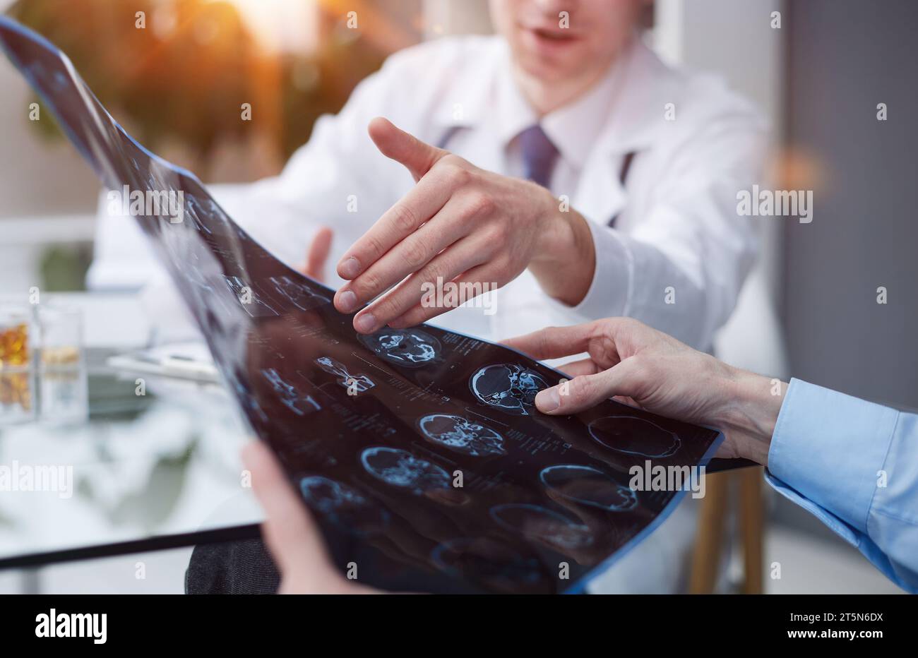 shows the x-ray image to the patient at the reception Stock Photo - Alamy