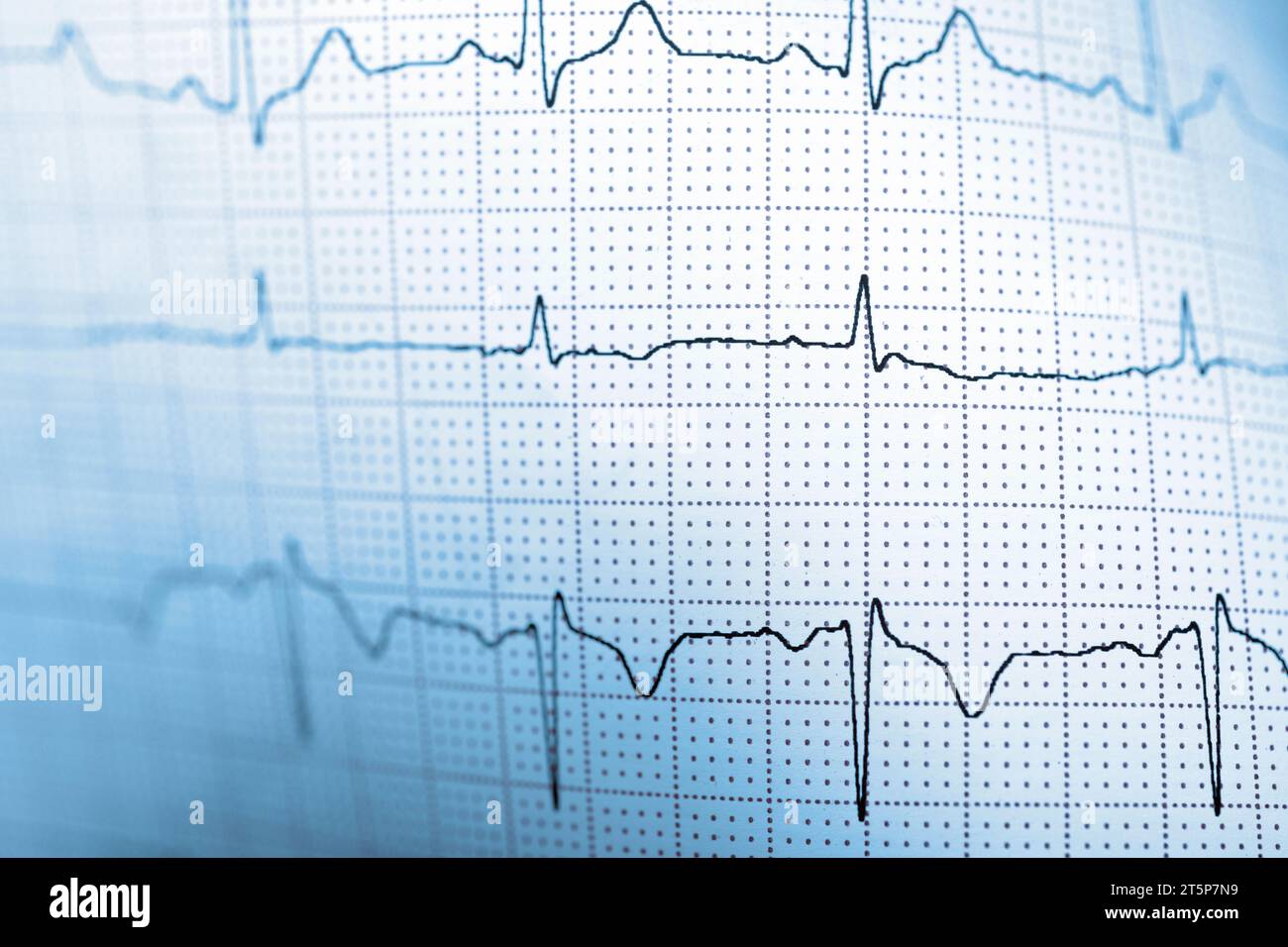 Electrocardiogram showing the pulse of the human heart Stock Photo - Alamy