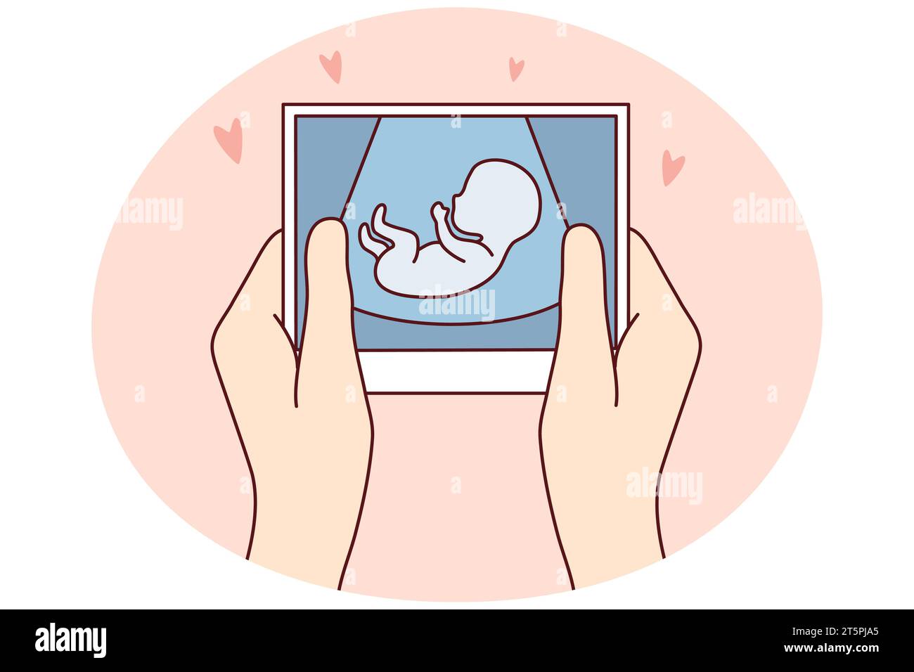 Hands of person holding scan of embryo waiting for baby birth. Future ...