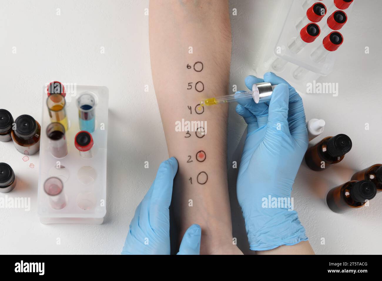 Doctor doing skin allergy test at light table, top view Stock Photo - Alamy