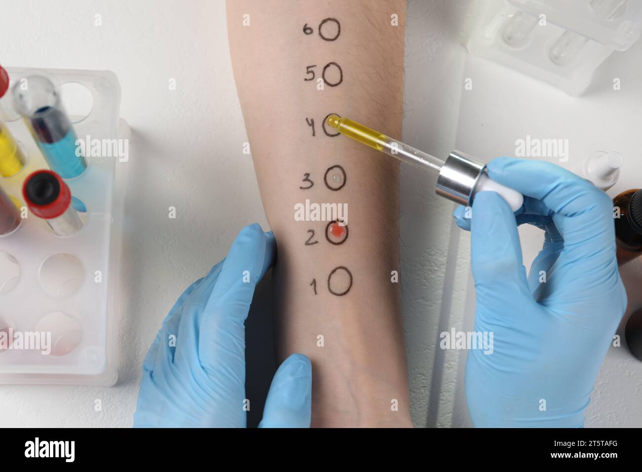 Doctor doing skin allergy test at light table, top view Stock Photo - Alamy