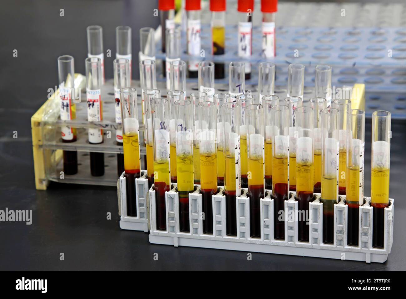 Laboratory tests glass tube, closeup of photo Stock Photo - Alamy