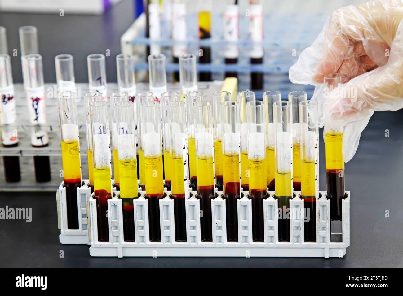Laboratory tests glass tube and hand, closeup of photo Stock Photo - Alamy