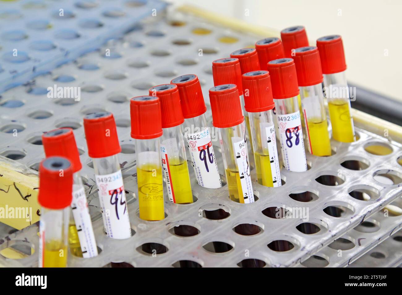 serum samples in the test tube, closeup of photo Stock Photo - Alamy