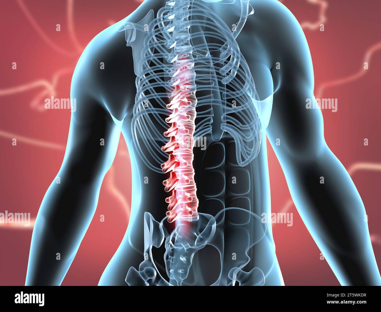 Spinal cord injury concept. 3d illustration Stock Photo - Alamy