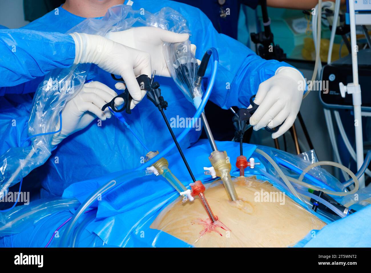 Many surgical manipulators in the hands of surgeons during surgery ...