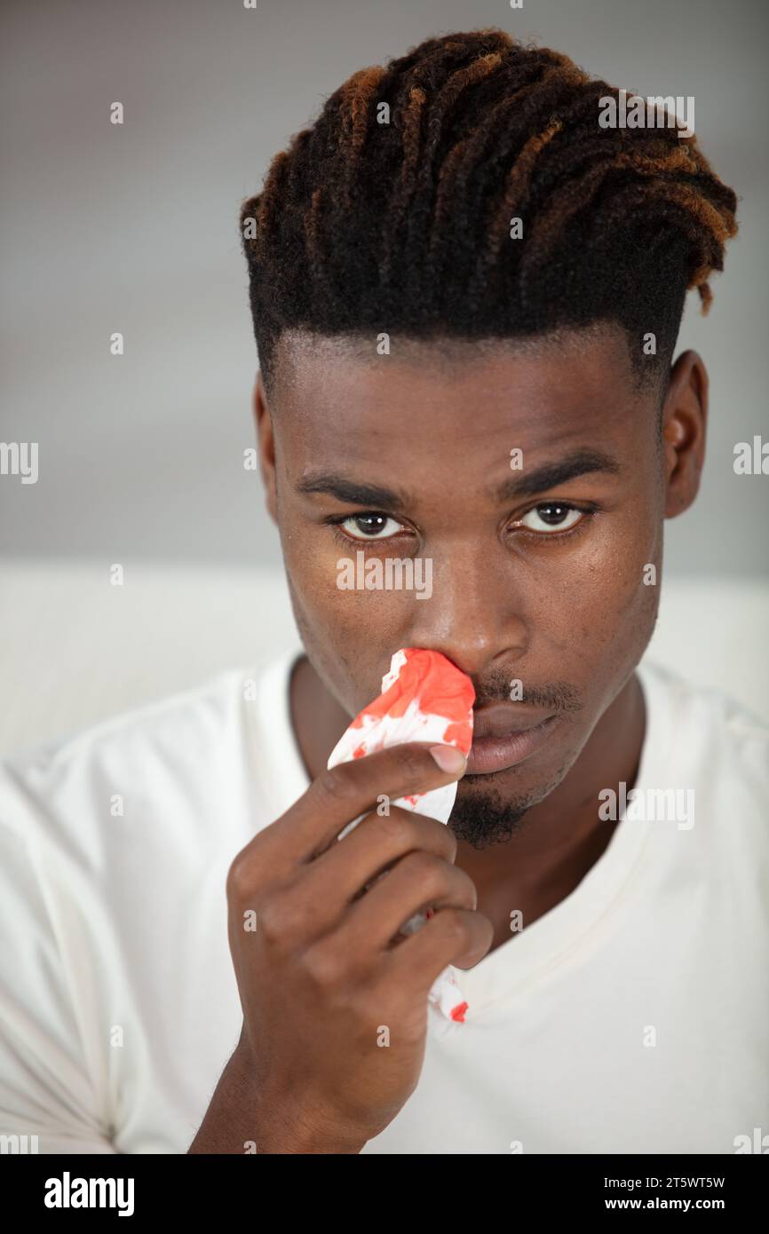 Nose bleed first aid hi-res stock photography and images - Alamy