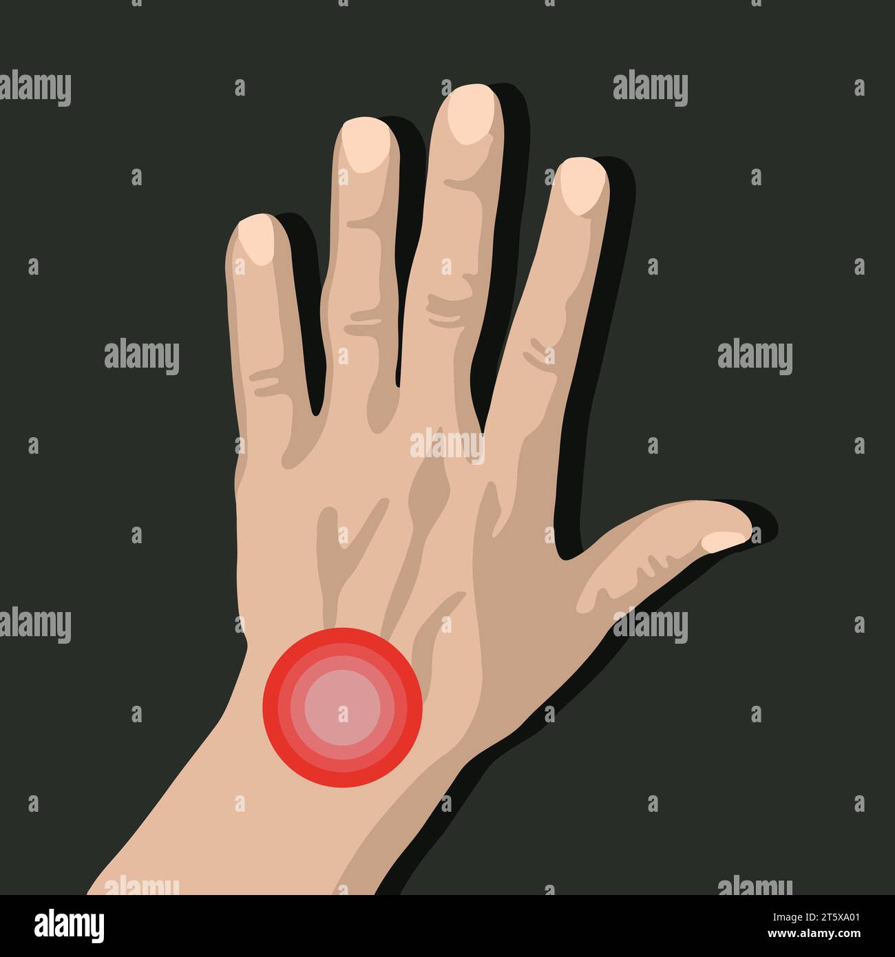 Vector isolated illustration of wrist pain. Hand with localization of ...