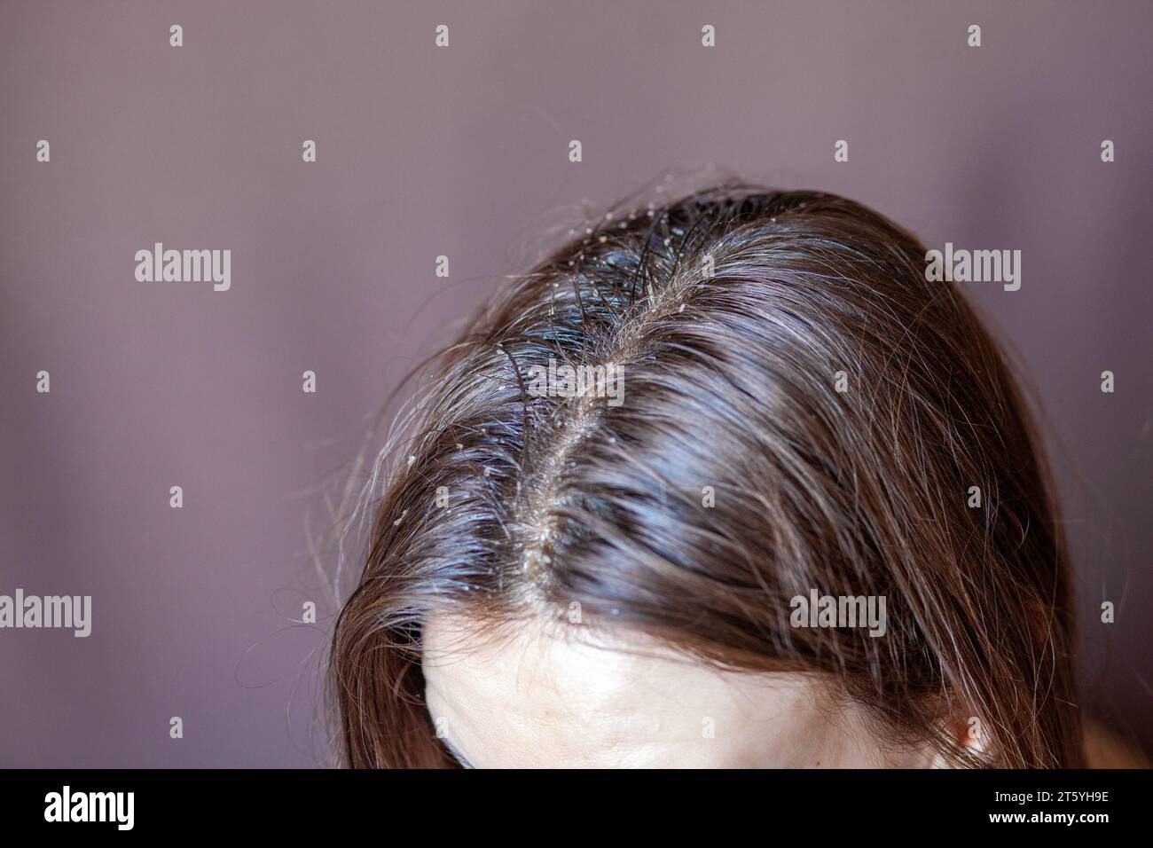 Parting of women's hair on the head. Hair care and care Stock Photo - Alamy