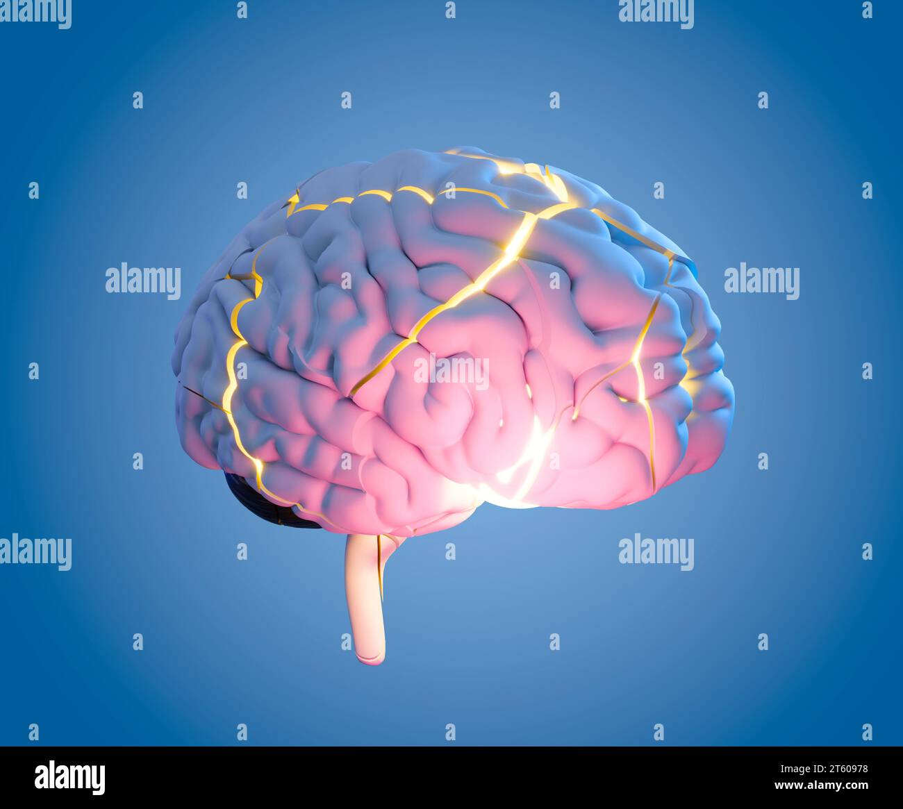 Memory lapses, forgetting things, degenerative disease. Brain problems ...