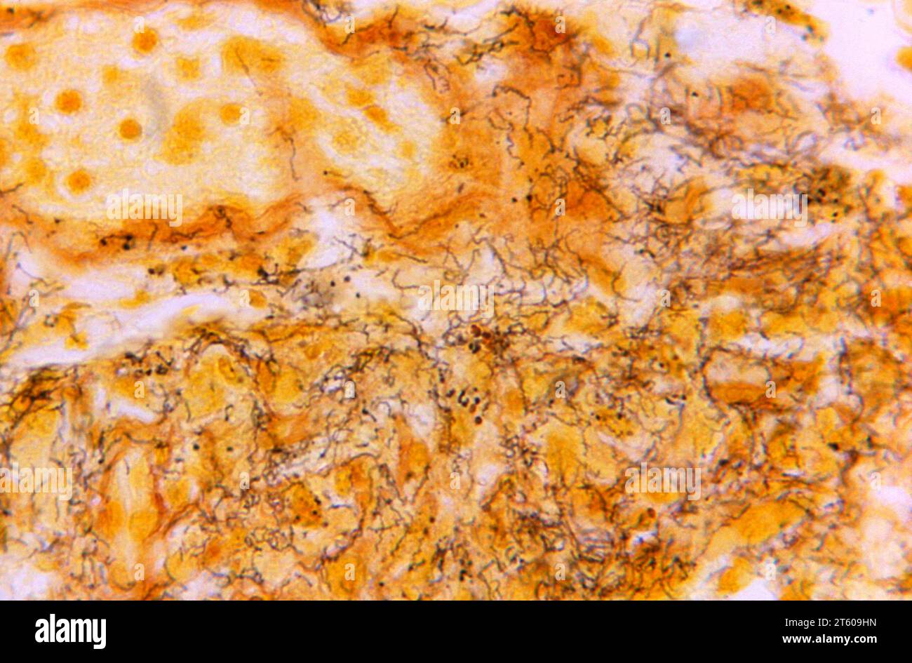 FILE - This 1966 microscope photo made available by the Centers for ...