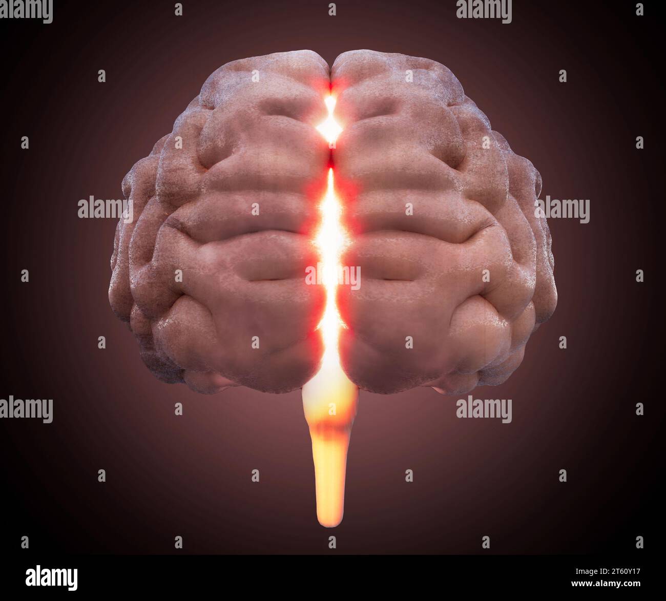 Memory lapses, forgetting things, degenerative disease. Brain problems ...