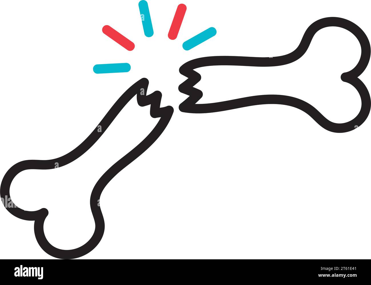 Medical broken bone hi-res stock photography and images - Alamy
