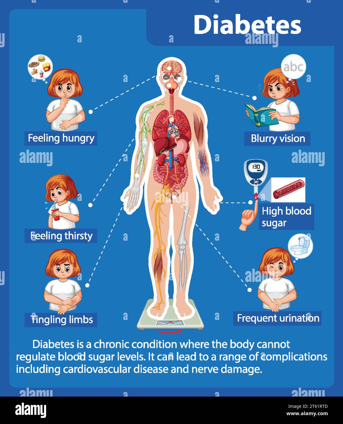 An infographic illustrating the effects of diabetes on the human body ...