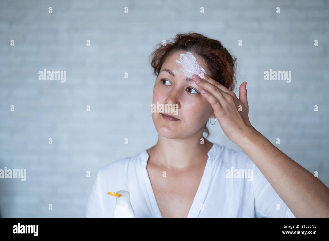 Vitiligo. Portrait of a woman with lack of skin pigmentation on her ...