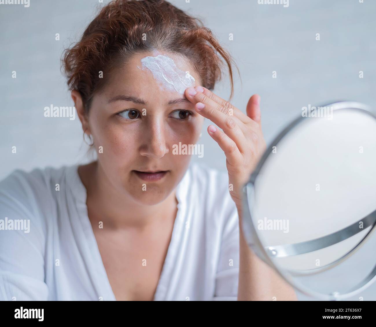 Portrait of a Caucasian woman with vitiligo uses sunscreen. A girl with ...