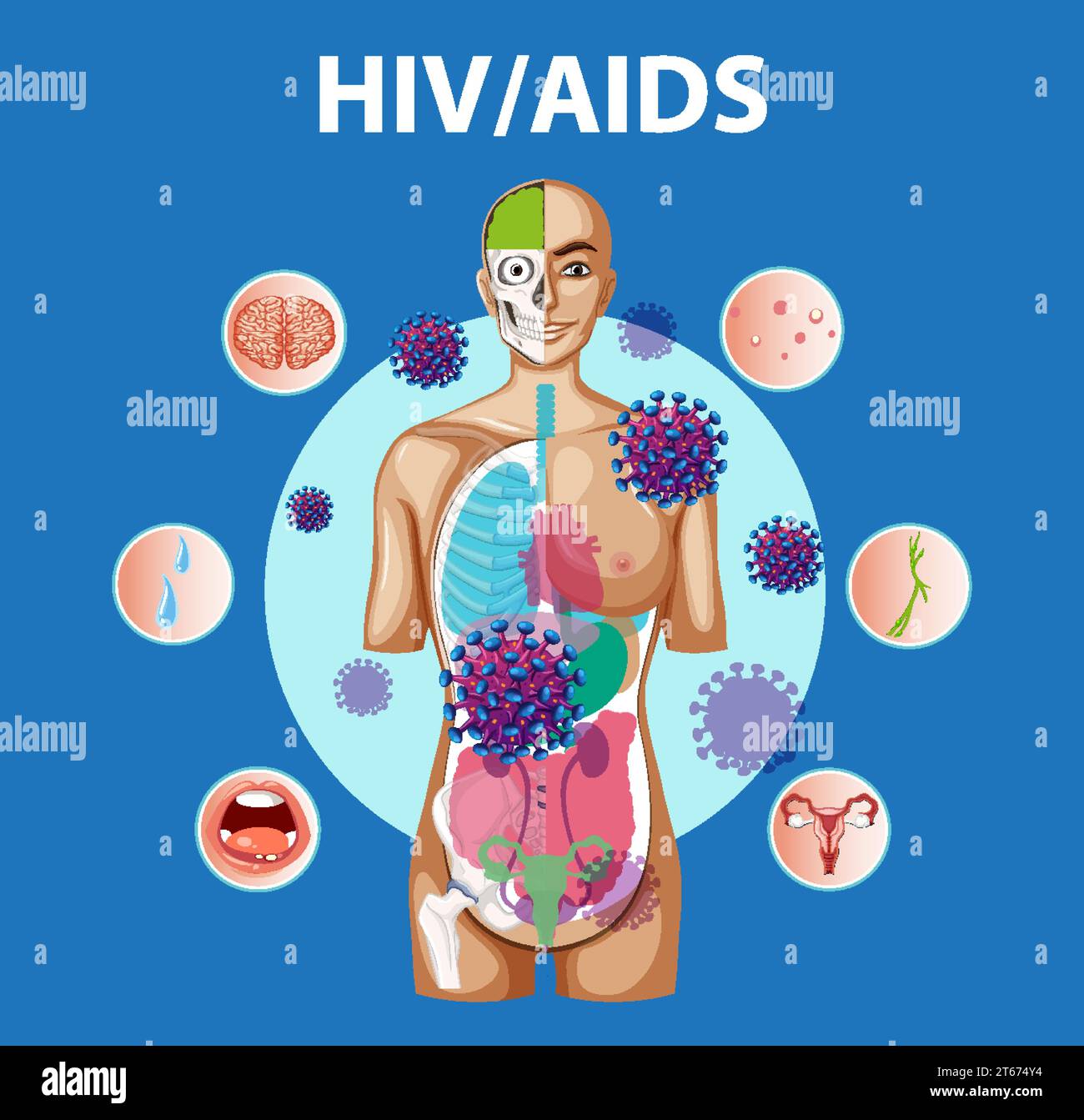 Illustration depicting the impact of HIV/AIDS on the human body Stock Vector Image & Art - Alamy