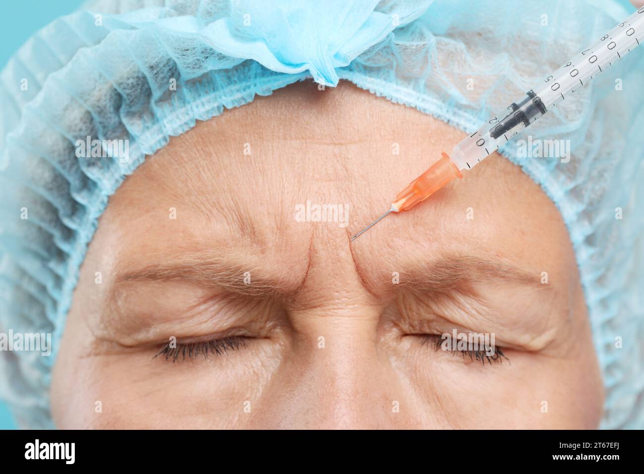 Senior woman getting facial injection, closeup. Cosmetic surgery Stock ...