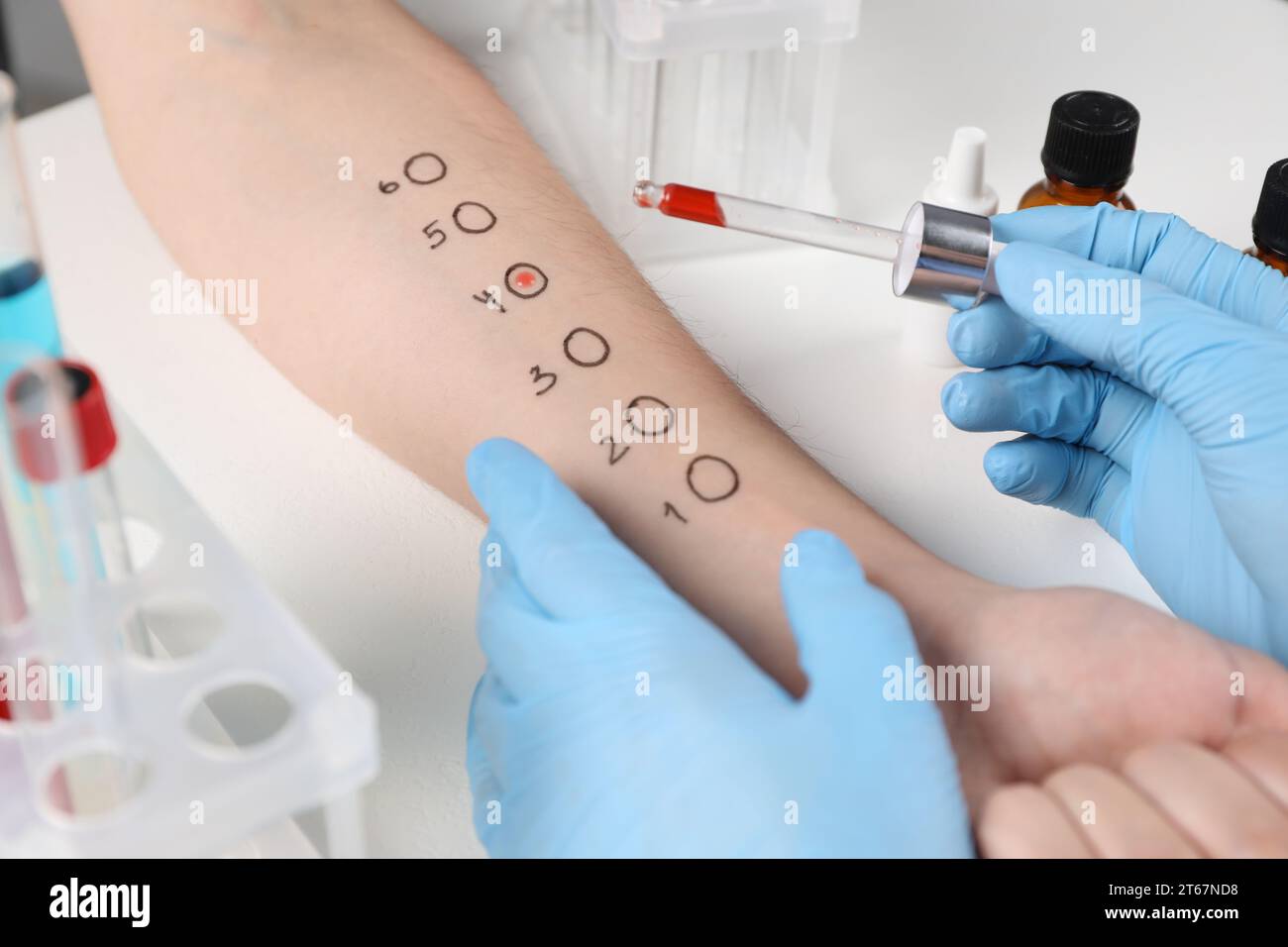 Doctor doing skin allergy test at light table, closeup Stock Photo - Alamy