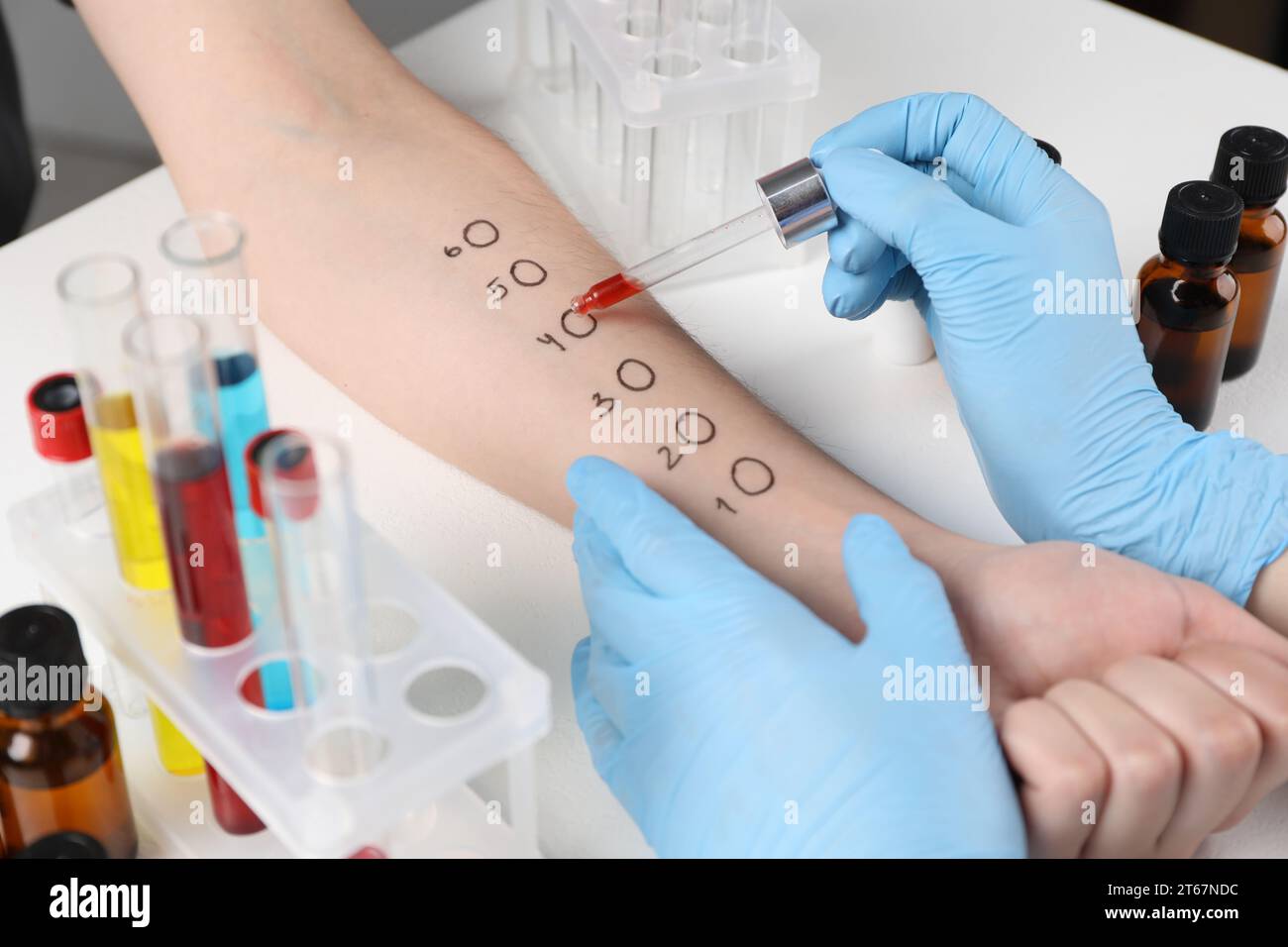 Doctor doing skin allergy test at light table, closeup Stock Photo - Alamy