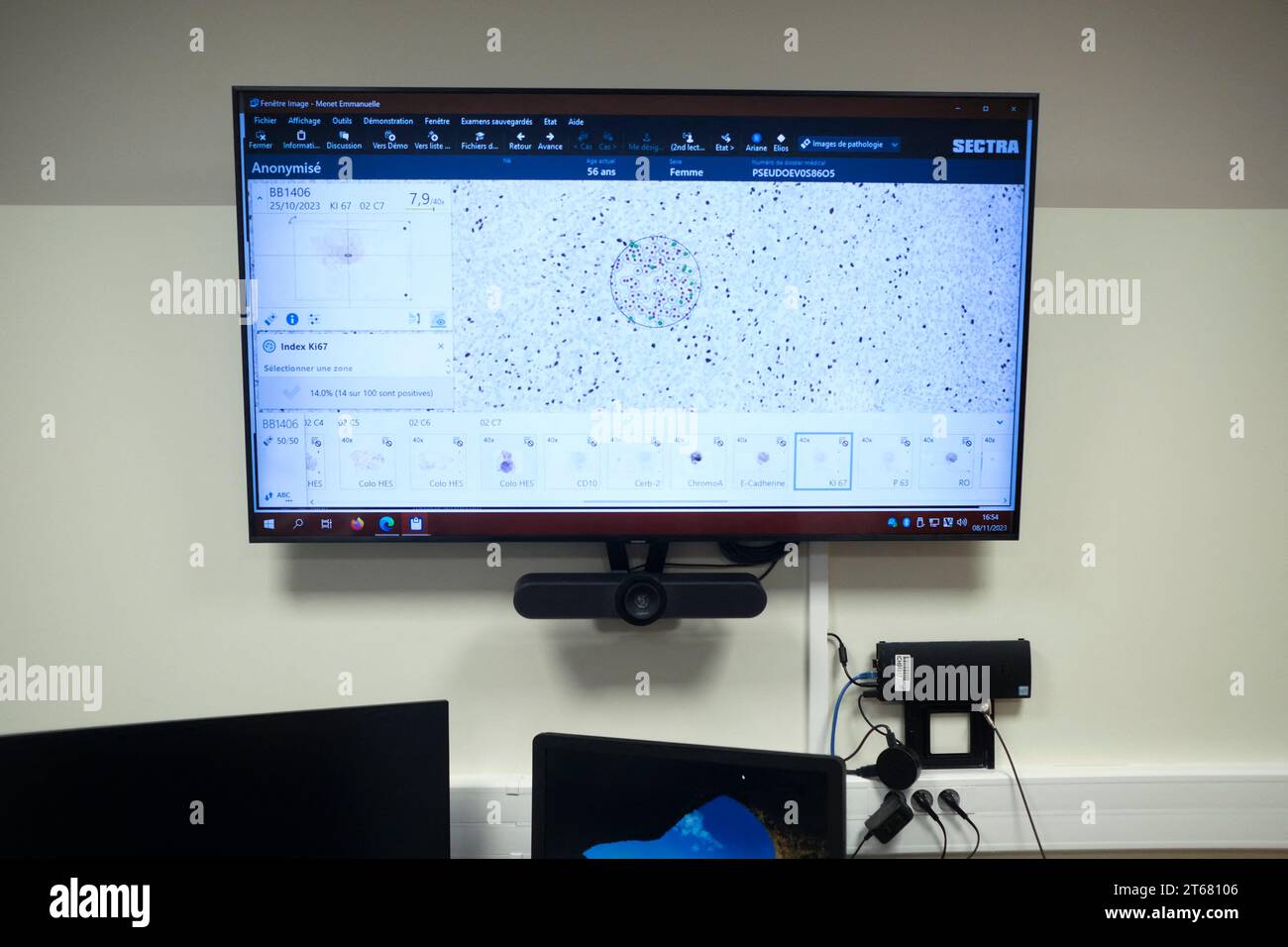 Saint Cloud, France. 01st June, 2023. The anatomopathology department ...