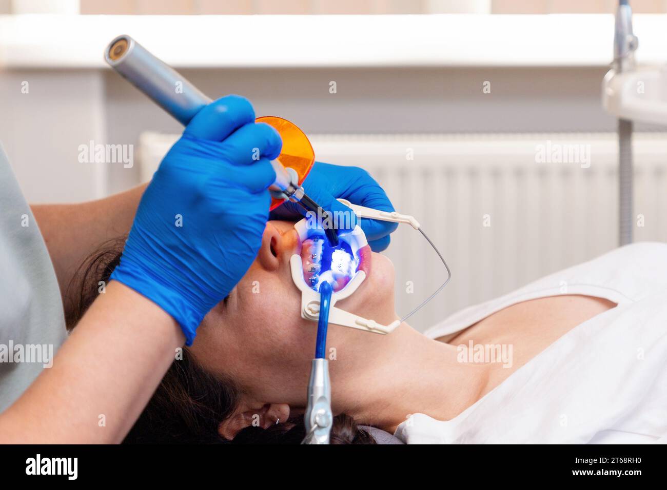 Side view of orthodontist fixes ligature braces on teeth of client ...