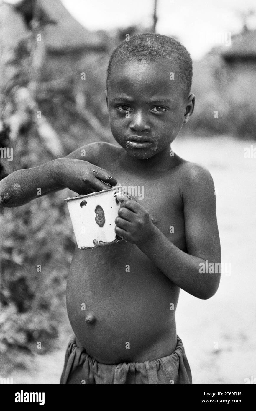 Angola, South Angola 26.02.1993 Archive No.: 39-29-14 Photo: starving ...