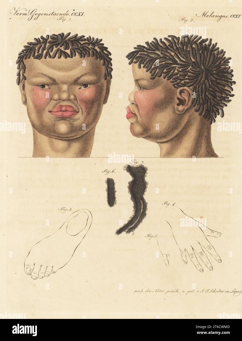 Portrait and profile of a 20-year-old Khoekhoe or Khoikhoi man of South ...