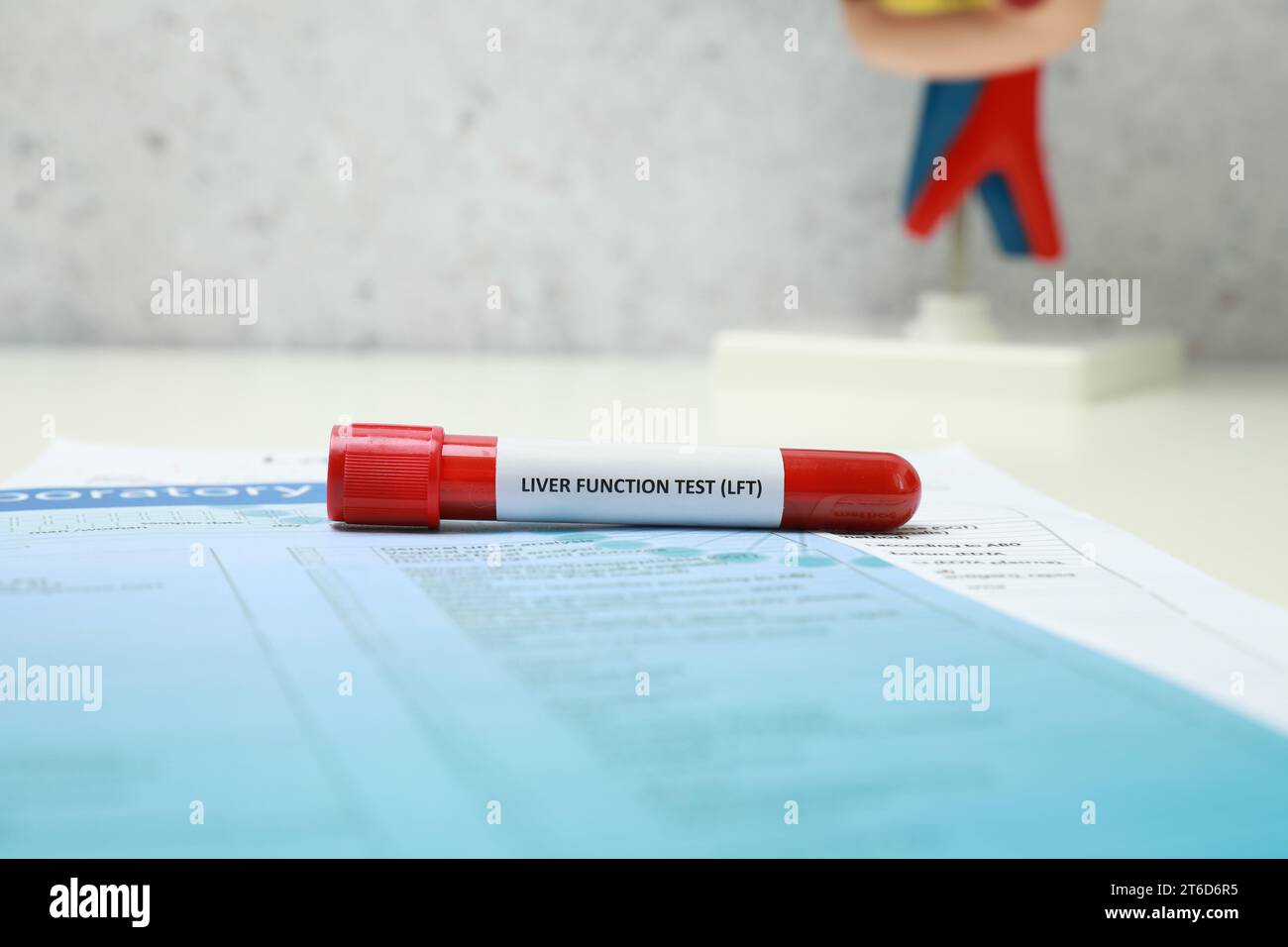 Liver Function Test. Tube with blood sample and forms on table Stock ...