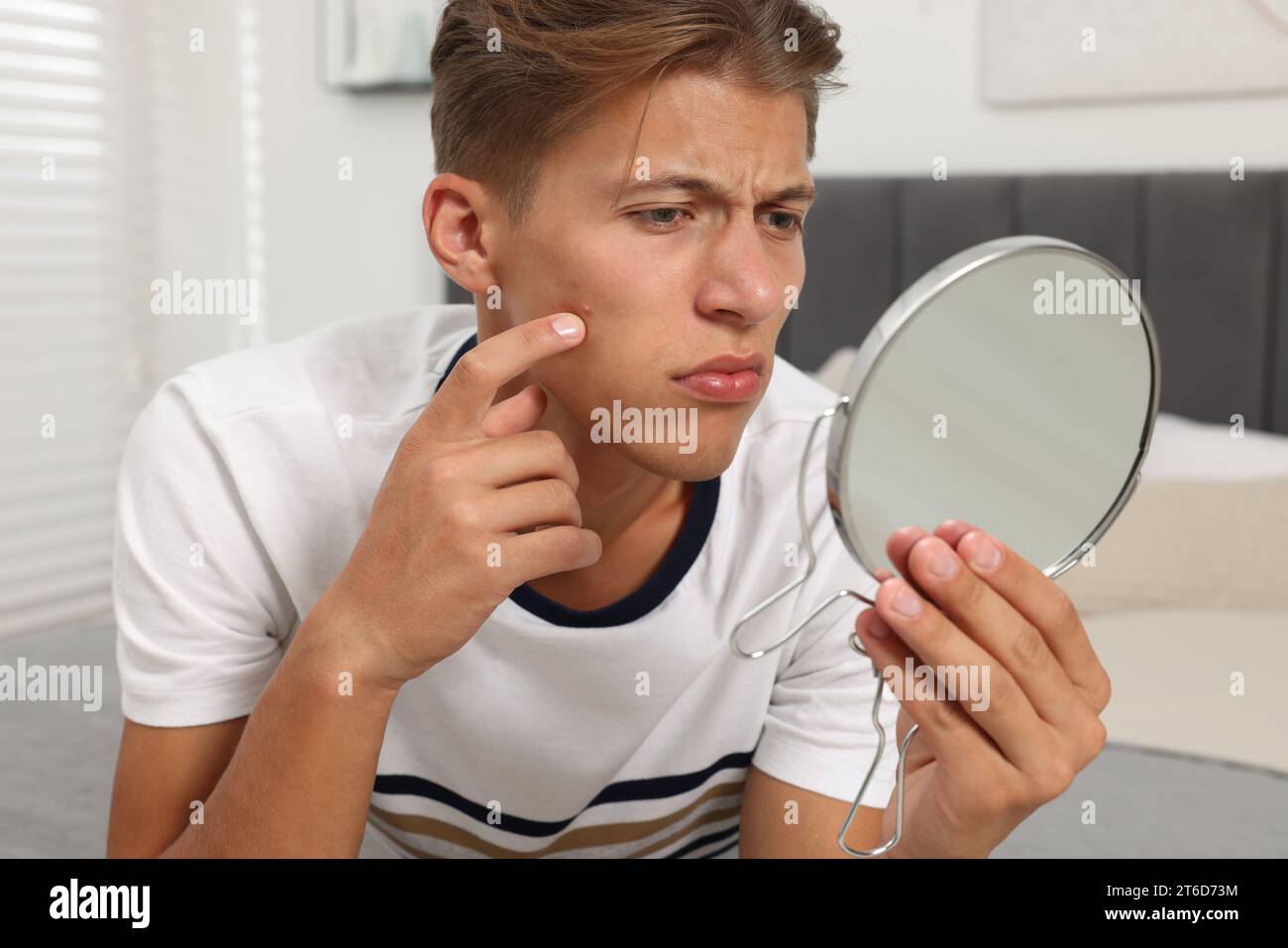 Upset young man looking at mirror and touching pimple on his face ...
