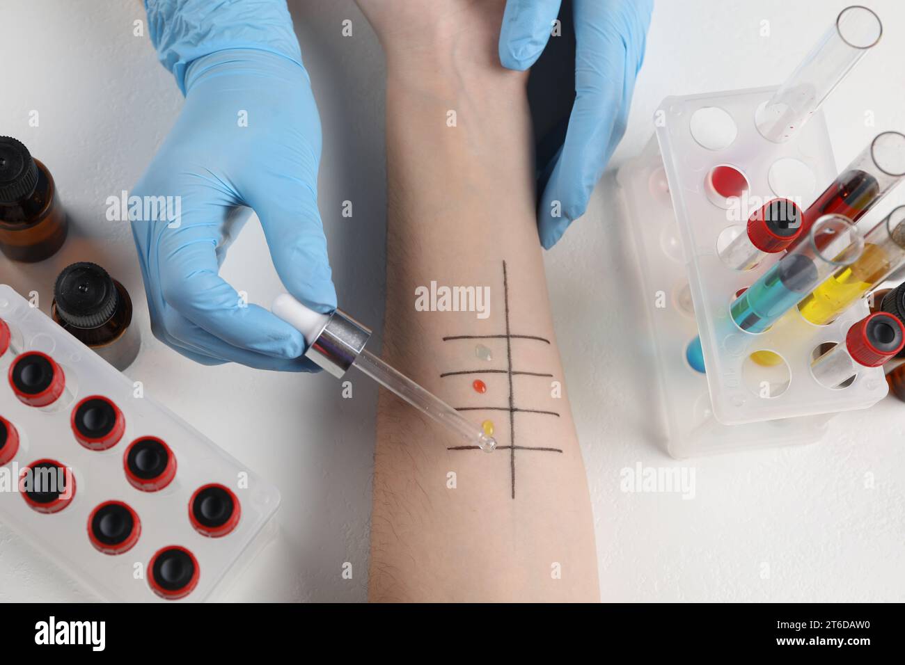 Doctor doing skin allergy test at light table, top view Stock Photo - Alamy